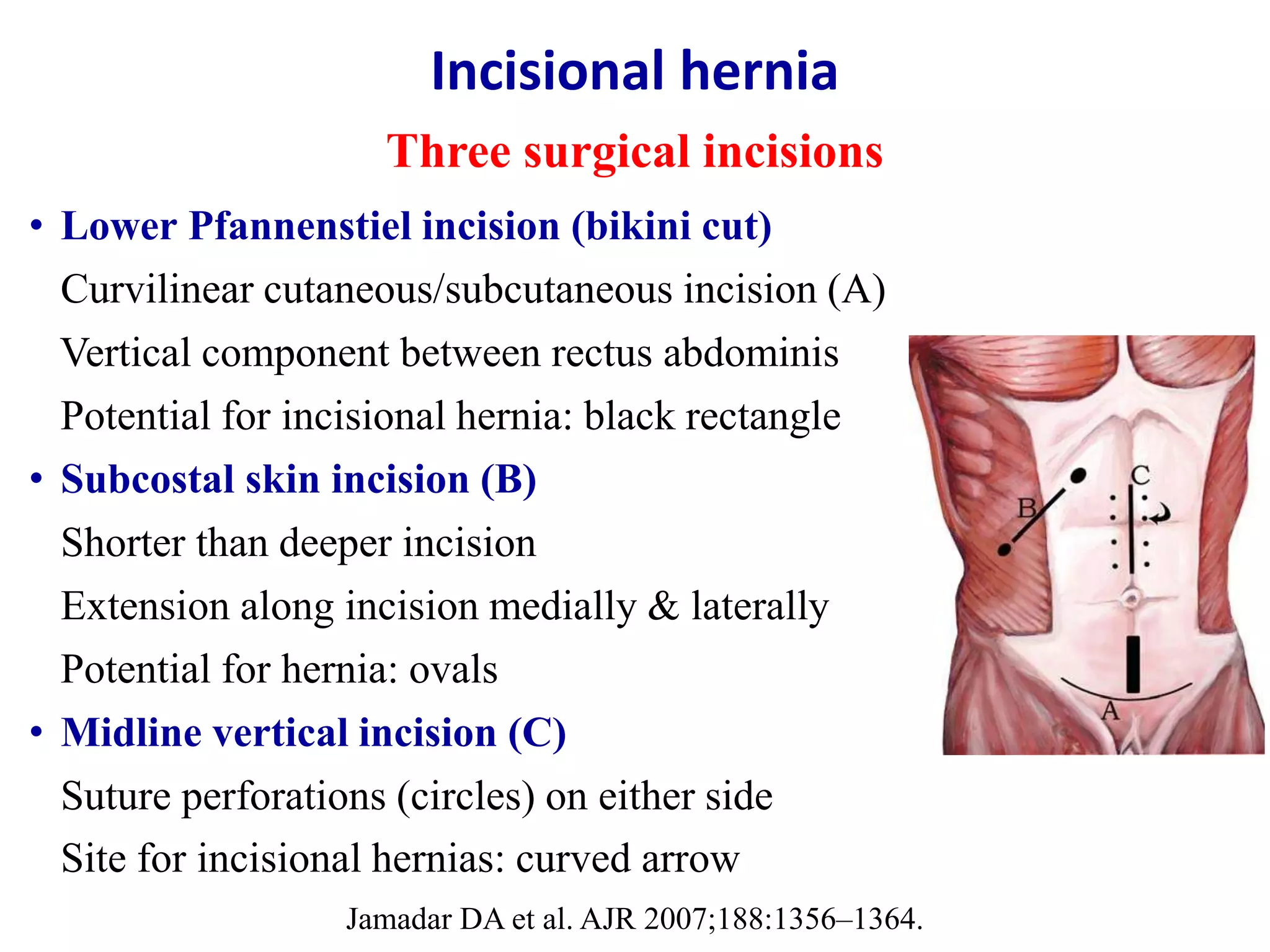 Ultrasound of groin & anterior abdominal wall hernias | PPTX