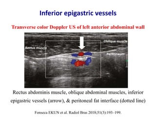 Ultrasound of groin & anterior abdominal wall hernias | PPTX