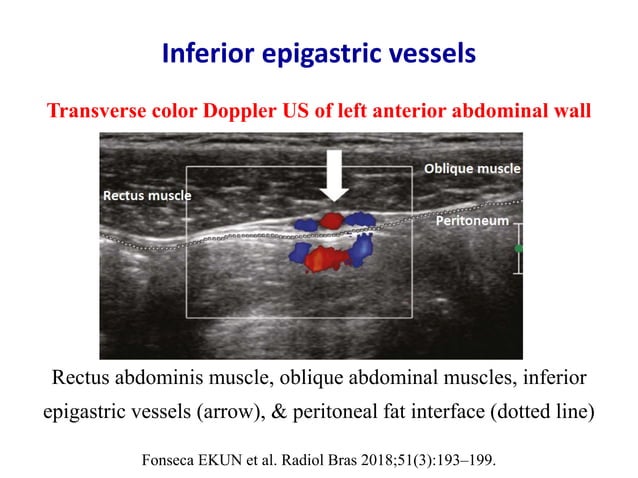 Ultrasound of groin & anterior abdominal wall hernias | PPTX | Death ...