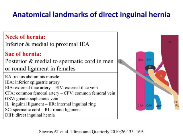 Ultrasound of groin & anterior abdominal wall hernias | PPTX | Death ...
