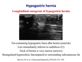 Ultrasound of groin & anterior abdominal wall hernias | PPTX