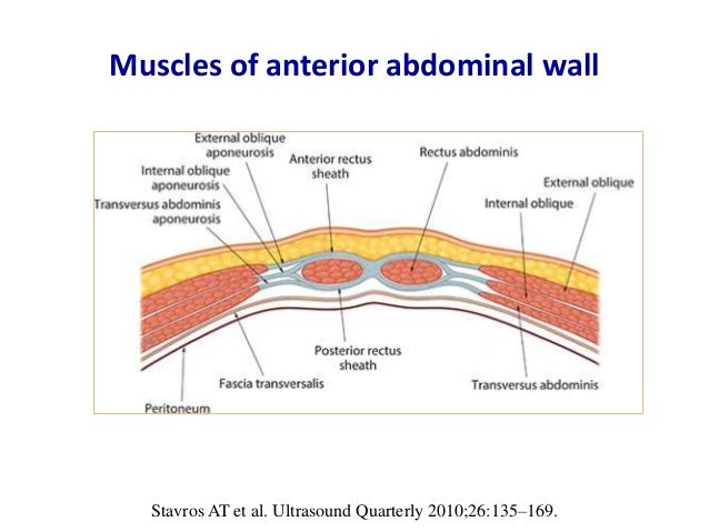 Ultrasound of groin & anterior abdominal wall hernias