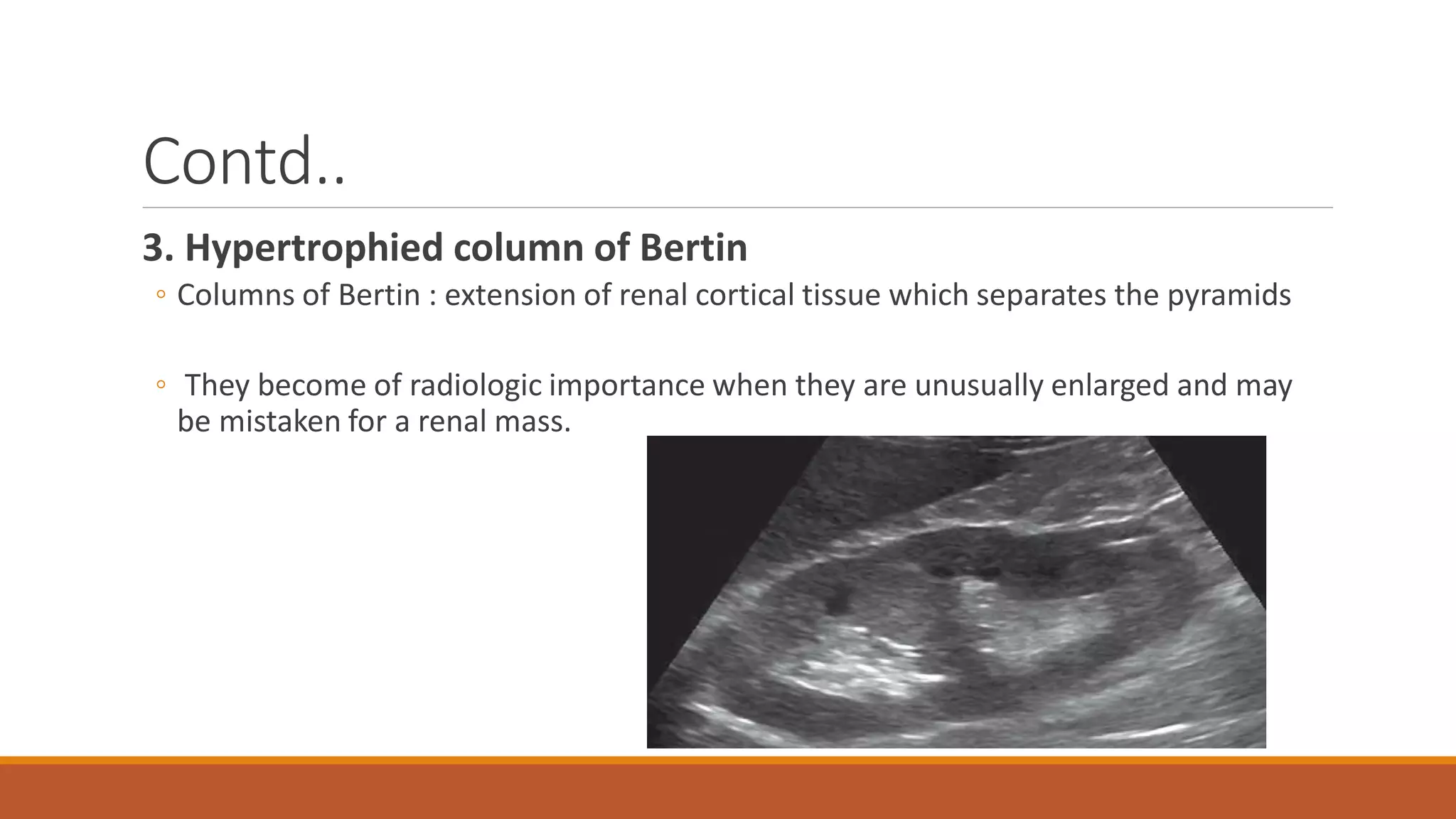 Ultrasound of Kidneys.pdf