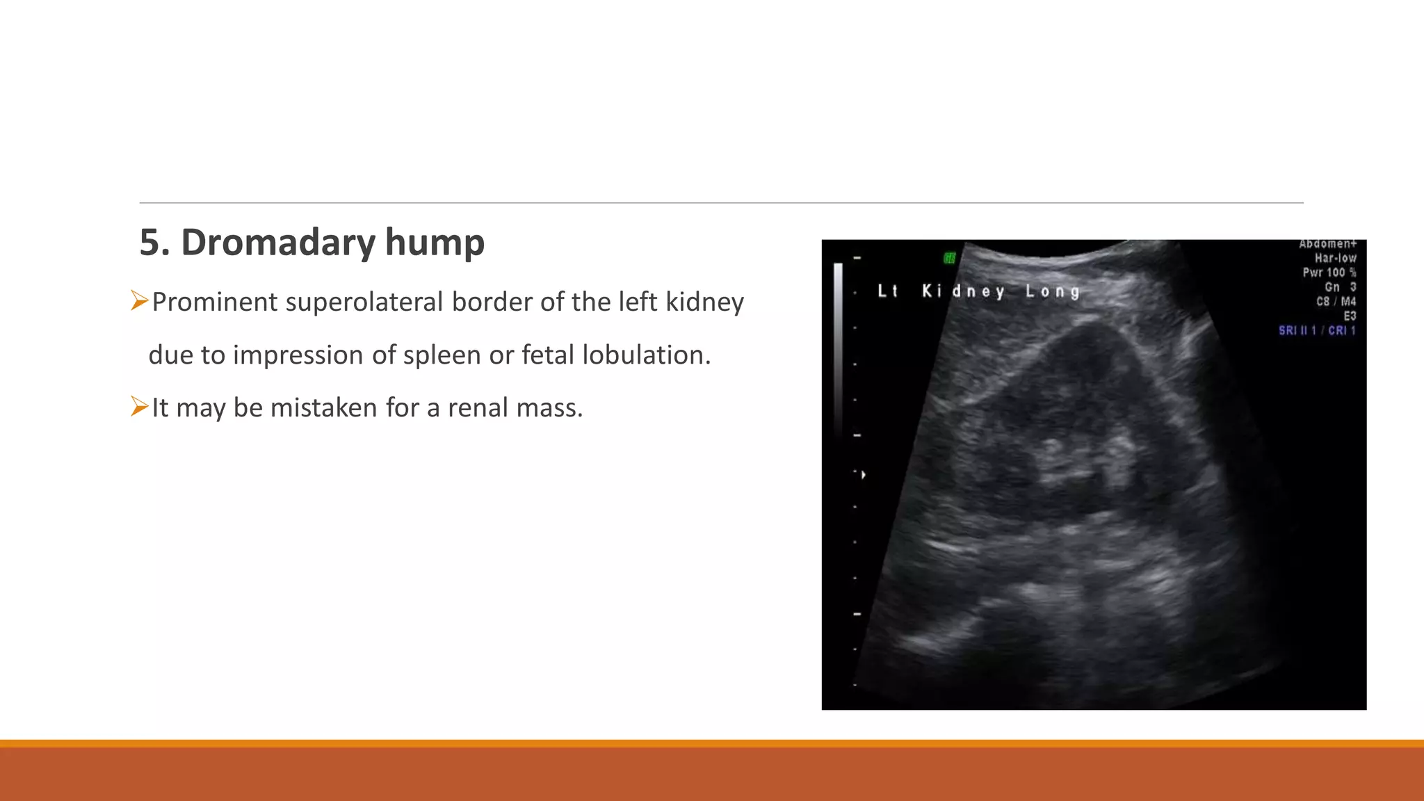 Ultrasound of Kidneys.pdf