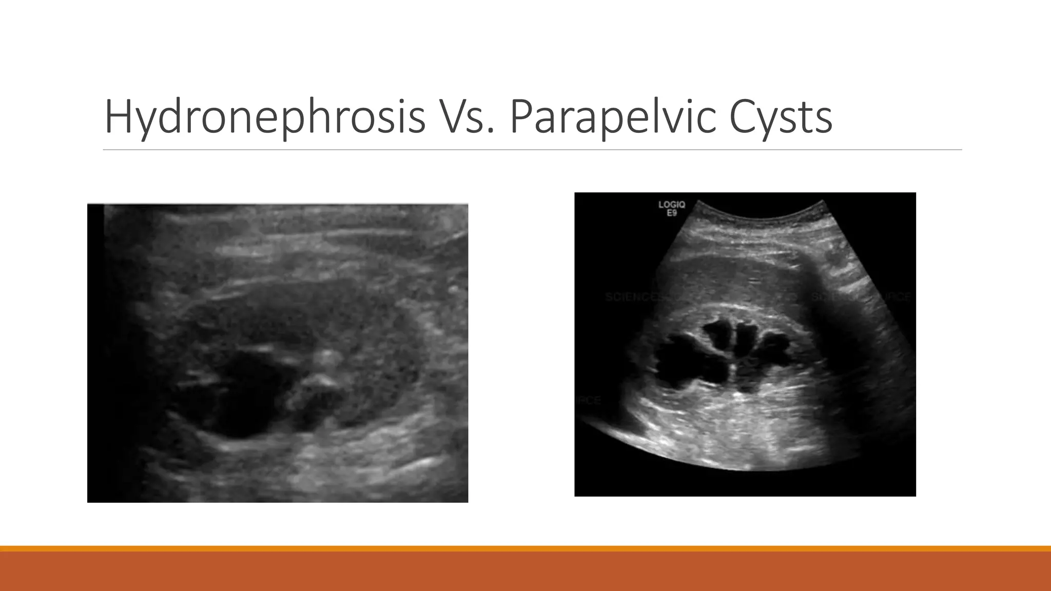 Ultrasound of Kidneys.pdf