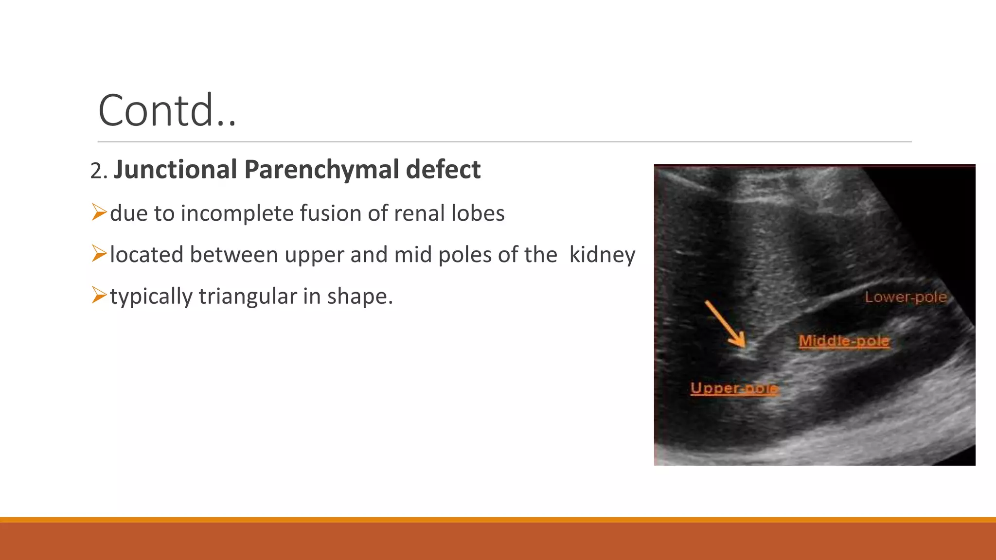 Ultrasound of Kidneys.pdf