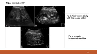 Ultrasound of Kidneys.pdf