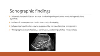 Ultrasound of Kidneys.pdf