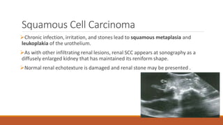 Ultrasound of Kidneys.pdf