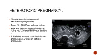 ULTRASOUND OF OBSTETRICS EMERGENCIES.pptx
