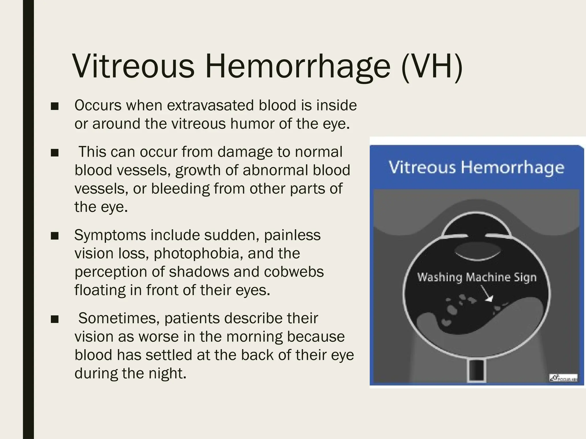 ULTRASOUND OF ORBIT & EYE- radiology description | PPTX