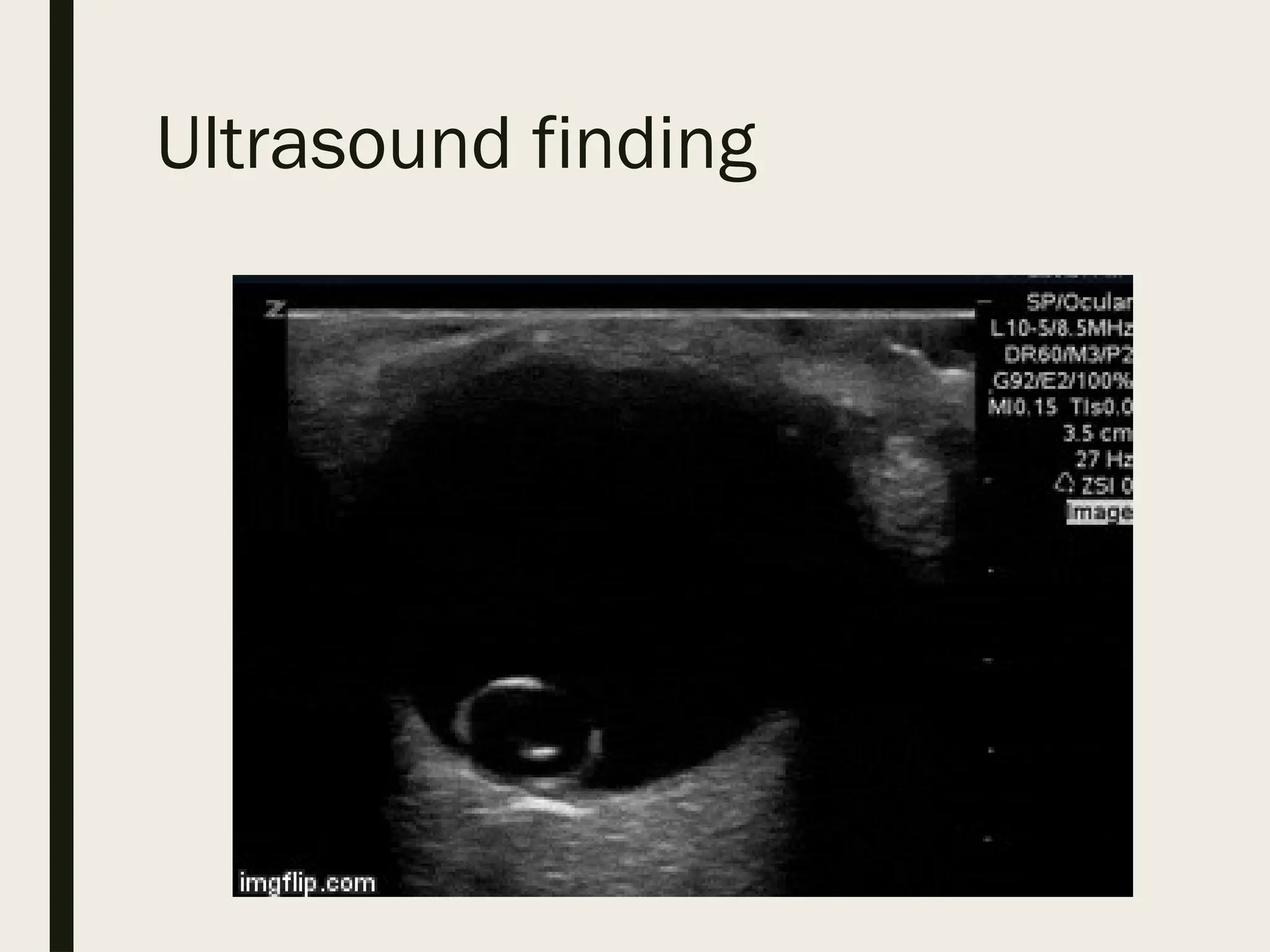 ULTRASOUND OF ORBIT & EYE- radiology description | PPTX