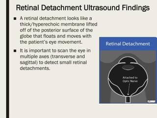 ULTRASOUND OF ORBIT & EYE- radiology description | PPTX