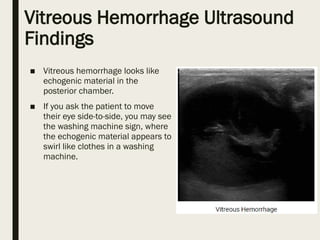 ULTRASOUND OF ORBIT & EYE- radiology description | PPTX