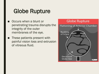 ULTRASOUND OF ORBIT & EYE- radiology description | PPTX