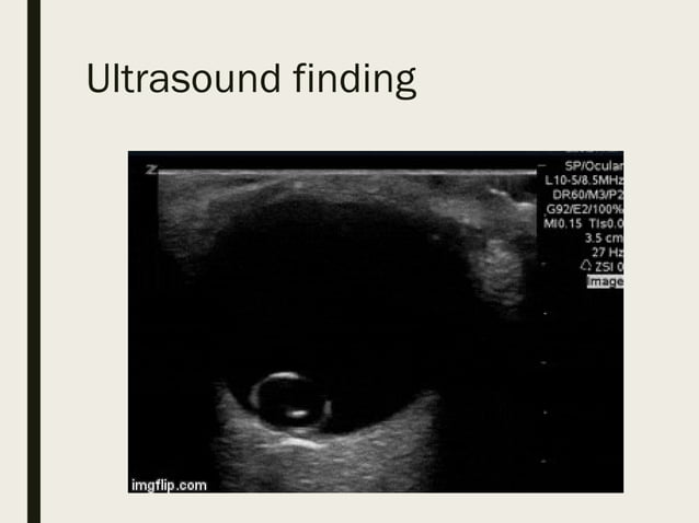 ULTRASOUND OF ORBIT & EYE- radiology description | PPTX