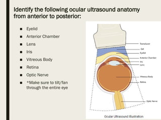 ULTRASOUND OF ORBIT & EYE- radiology description | PPTX