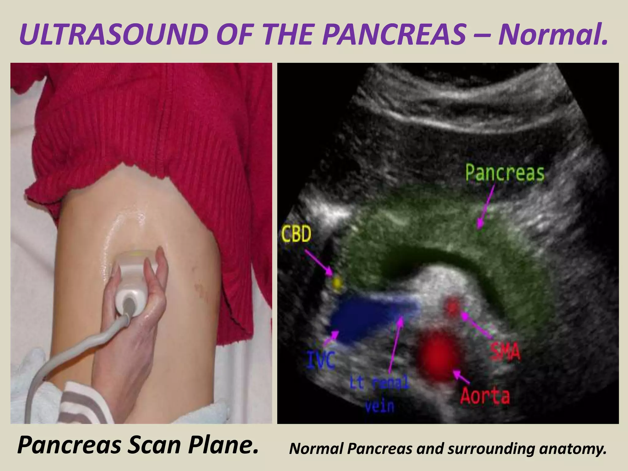 Ultrasound of pancrease in Radiology | PPTX