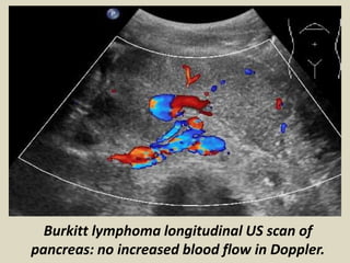Ultrasound of pancrease in Radiology | PPTX