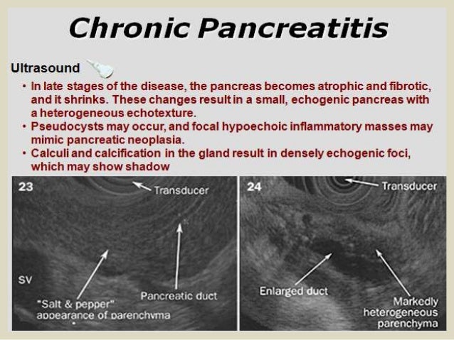 Ultrasound of pancrease in Radiology