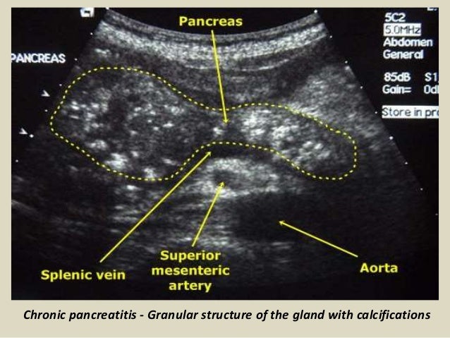 Ultrasound of pancrease in Radiology