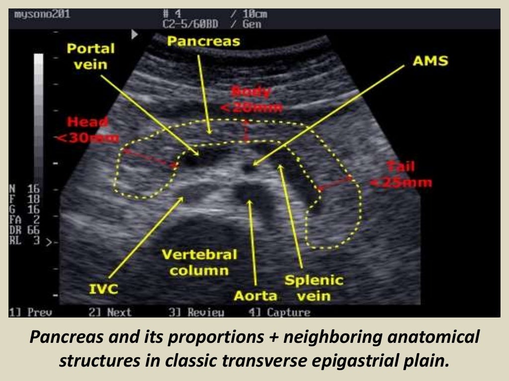 Ultrasound of pancrease in Radiology