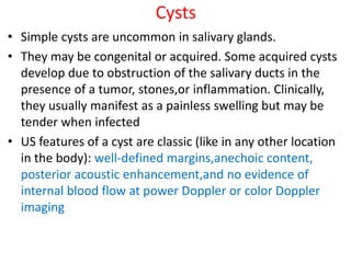 Ultrasound of salivary glands | PPTX