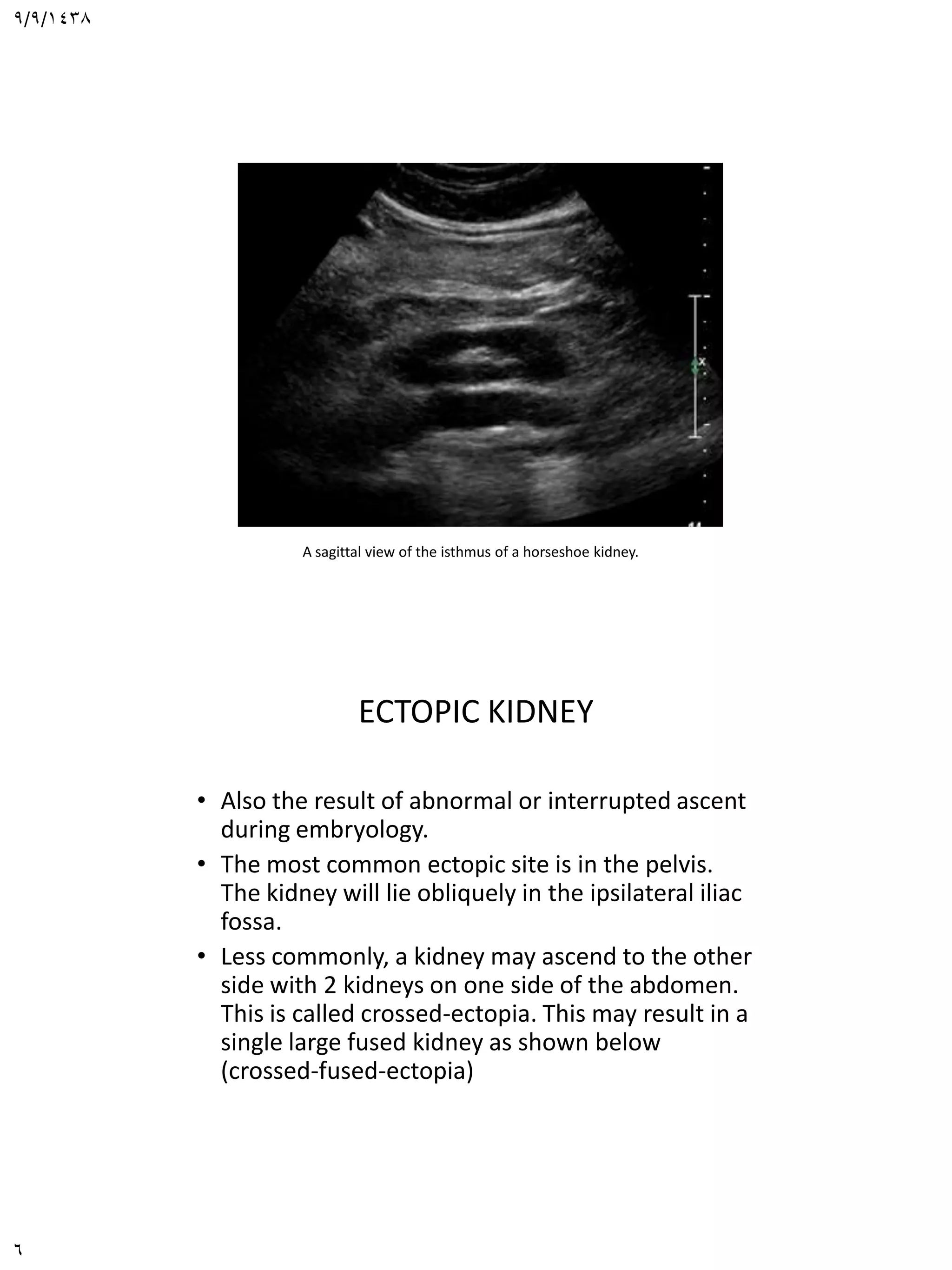 Ultrasound of the adult kidney | PDF