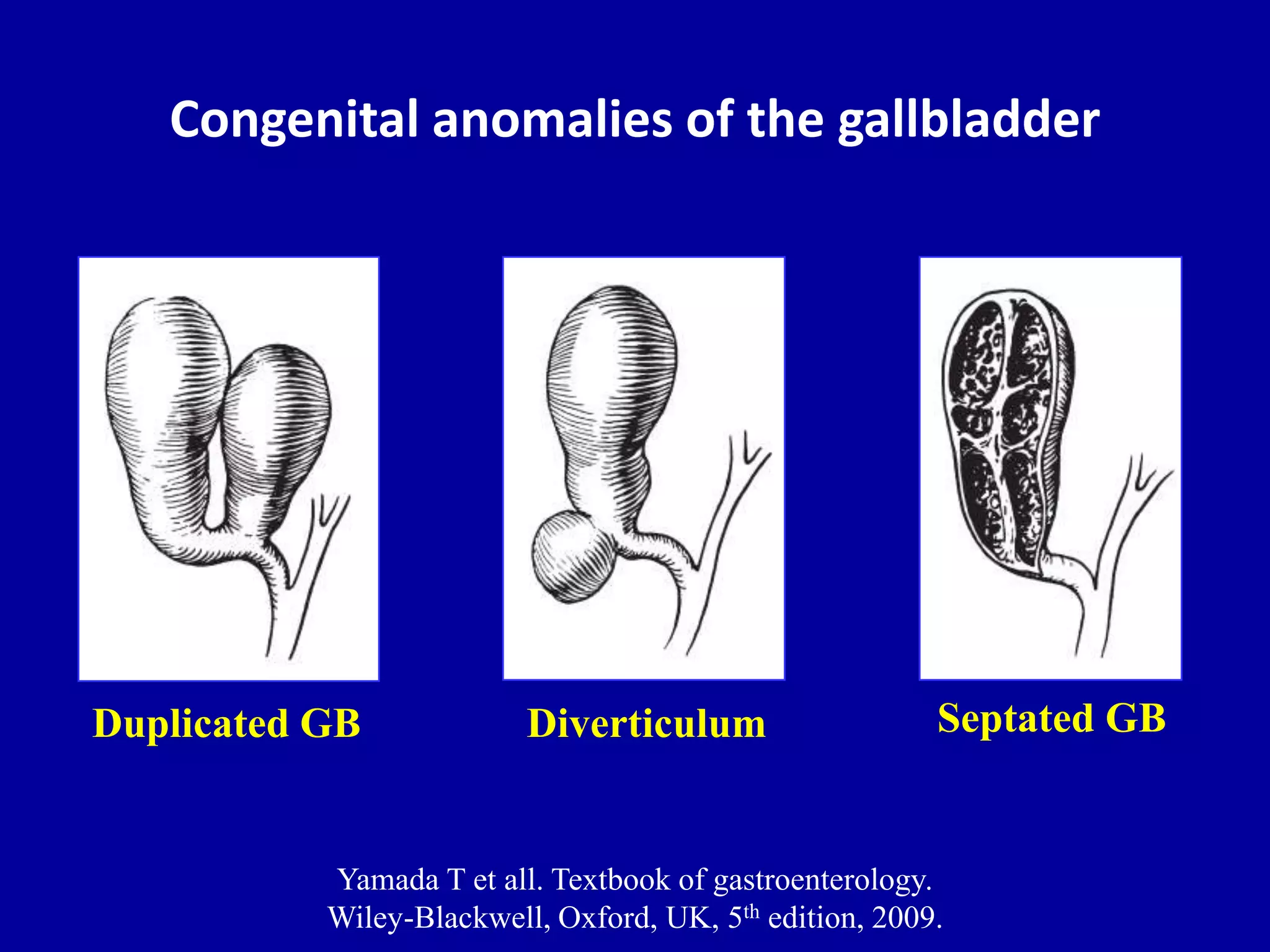 Ultrasound of the gallbladder | PPTX