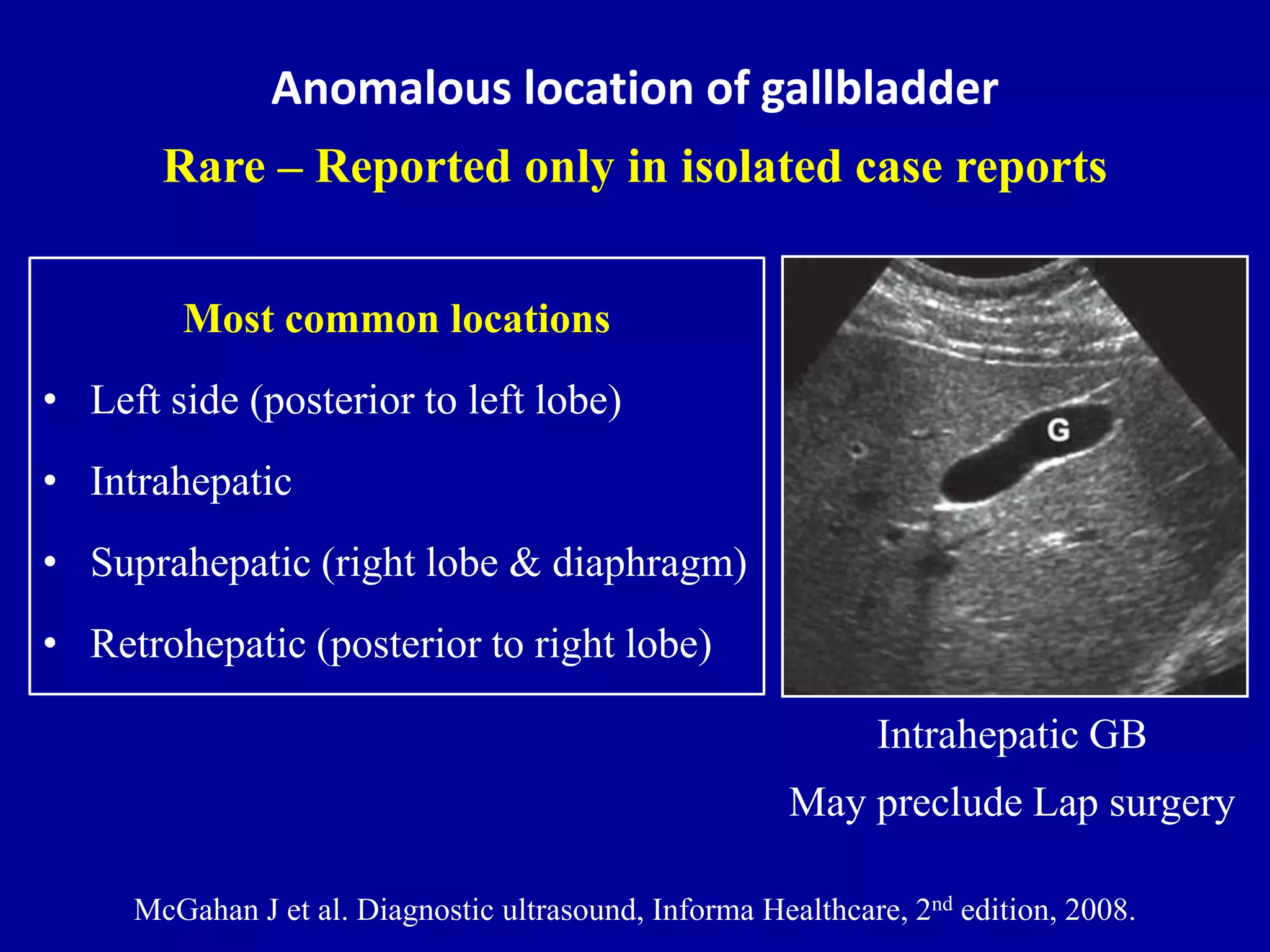 Ultrasound of the gallbladder | PPTX
