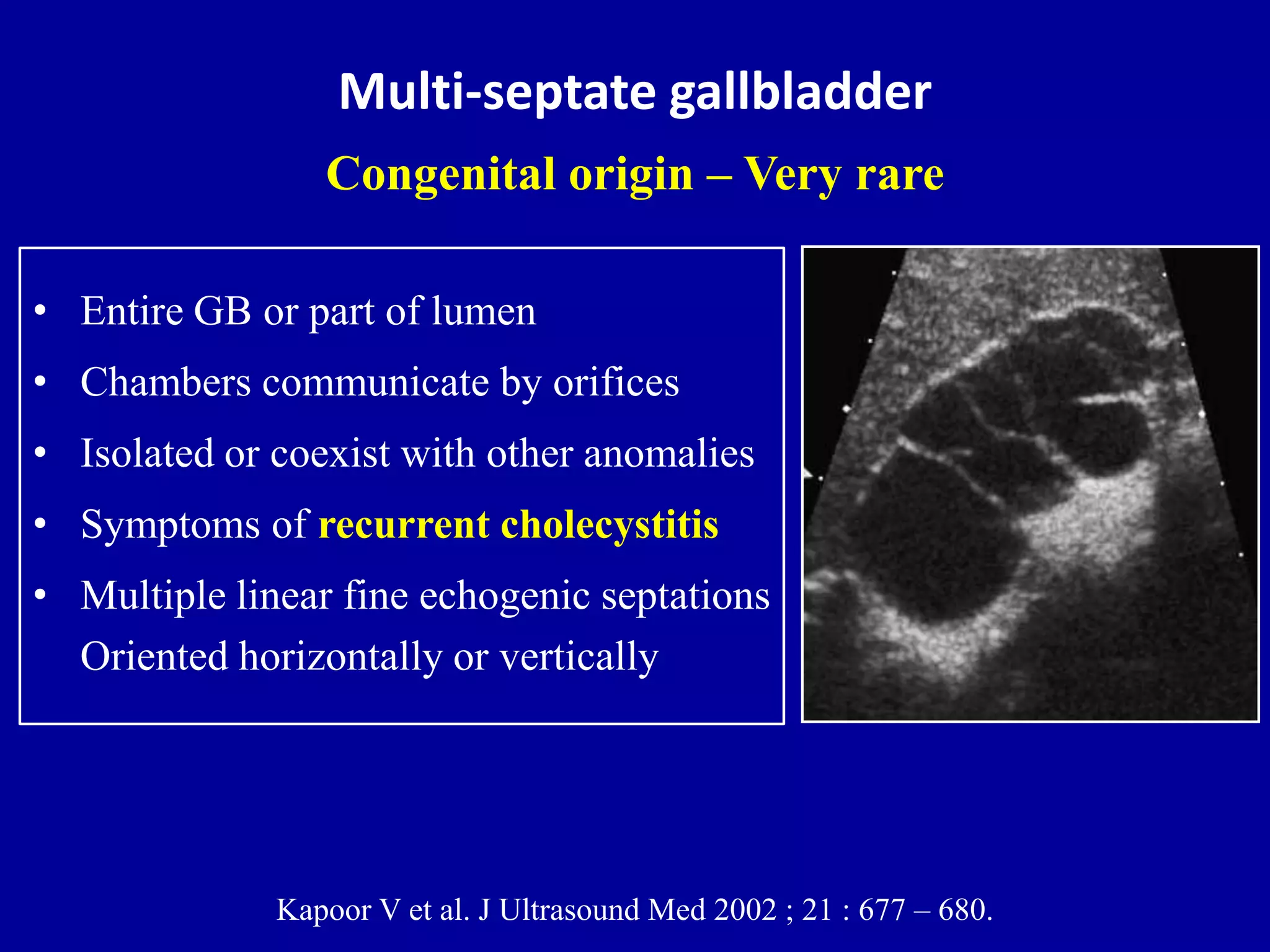 Ultrasound of the gallbladder | PPTX