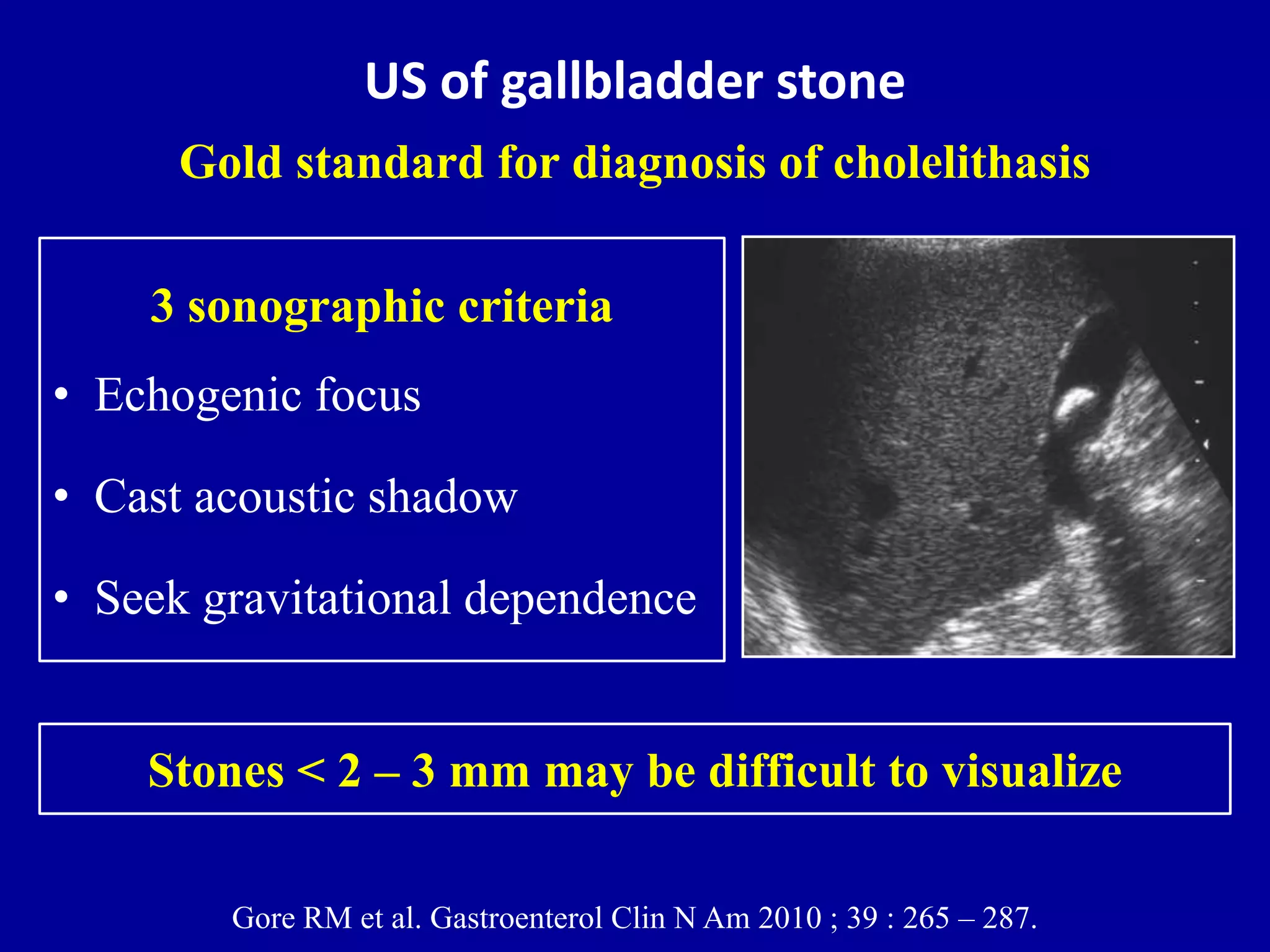 Ultrasound of the gallbladder | PPTX