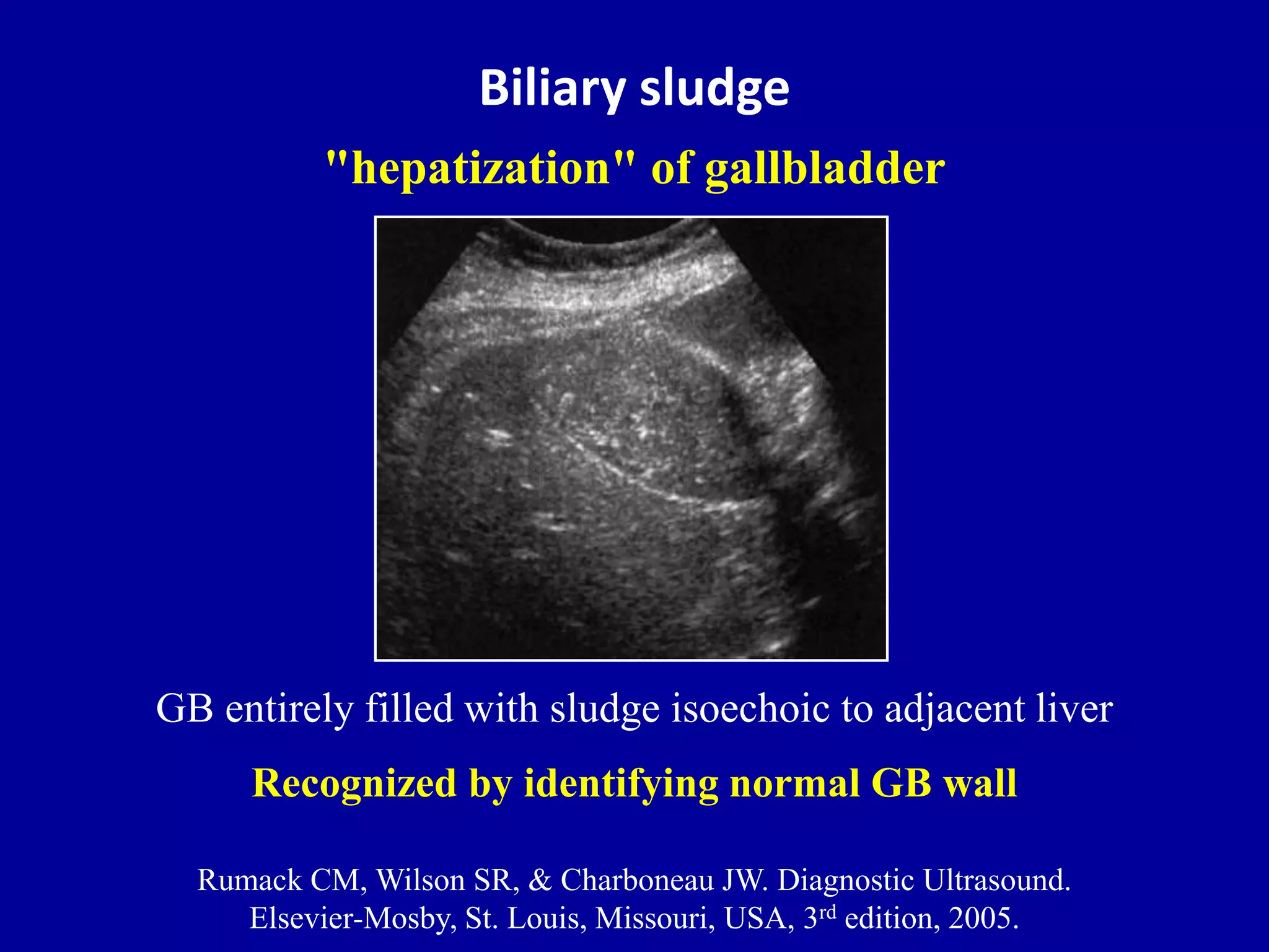 Ultrasound of the gallbladder | PPTX