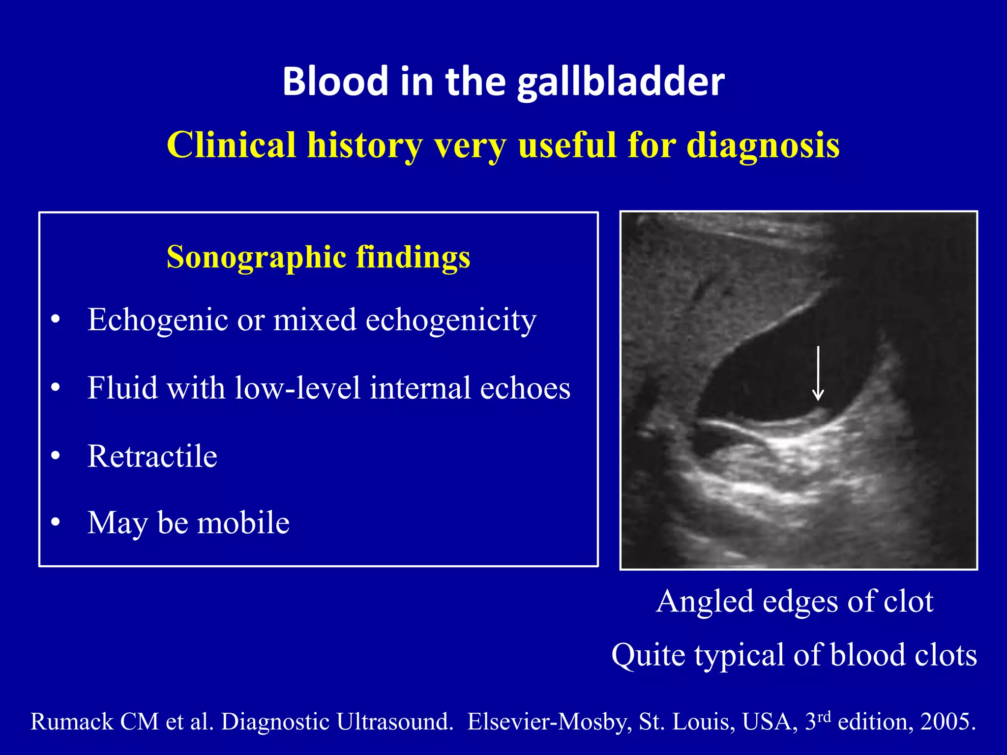 Ultrasound of the gallbladder | PPTX