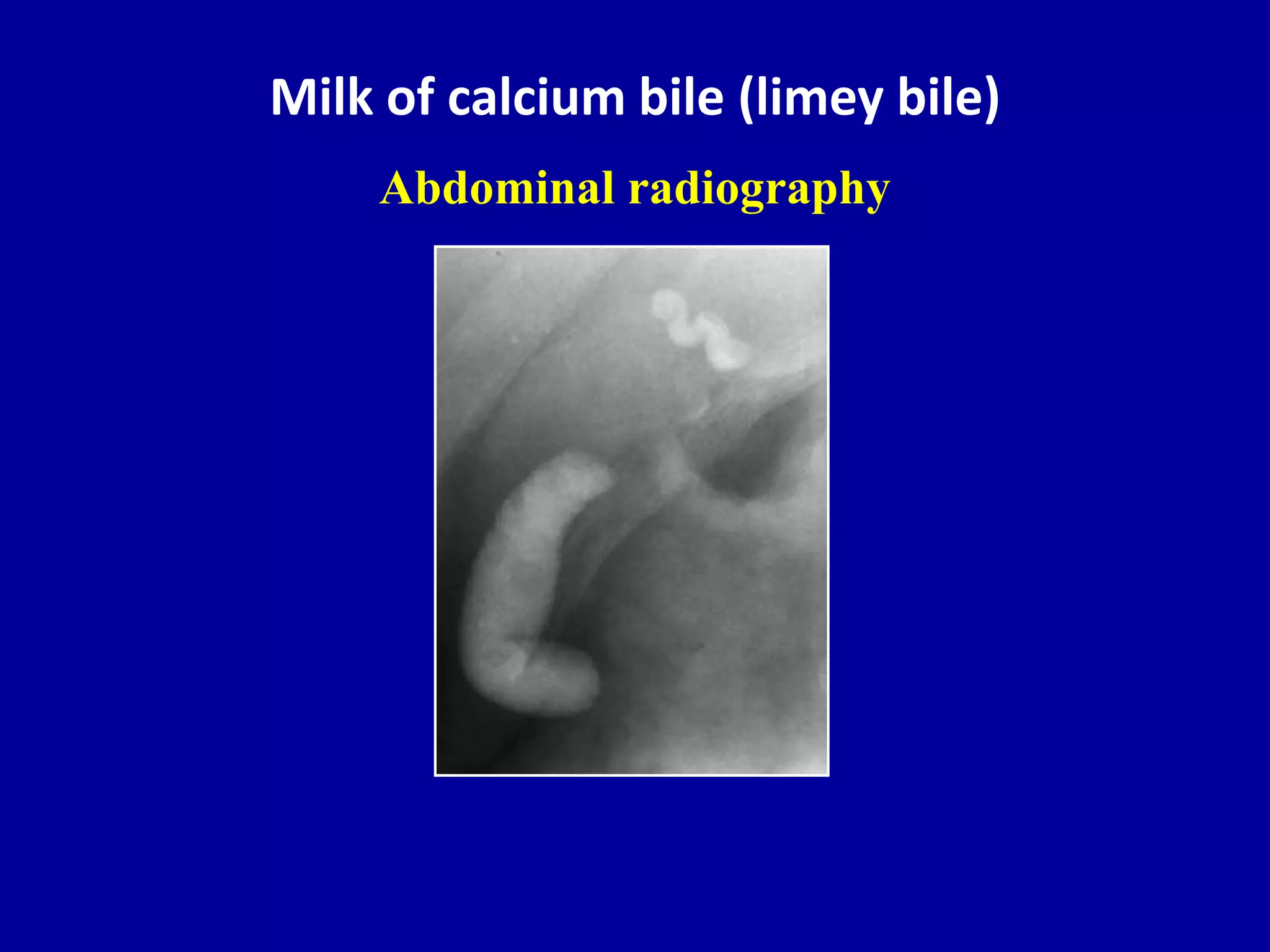 Ultrasound of the gallbladder | PPTX