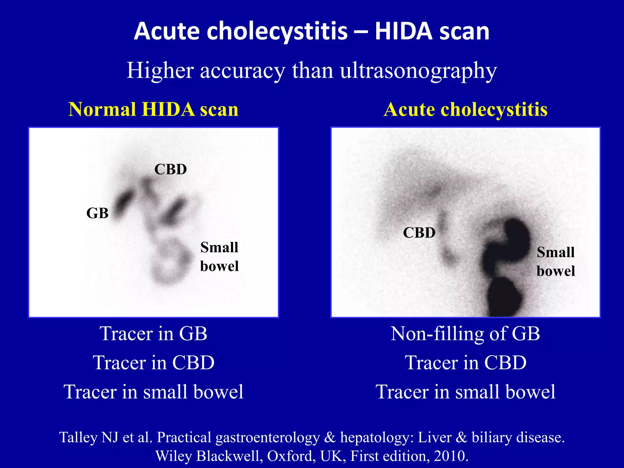 Ultrasound of the gallbladder | PPTX