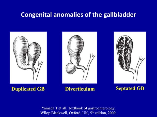 Ultrasound of the gallbladder | PPTX | Digestive Disorders | Diseases ...