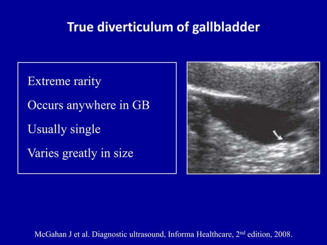 Ultrasound of the gallbladder | PPTX | Digestive Disorders | Diseases ...