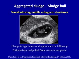 Ultrasound of the gallbladder | PPTX