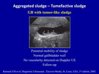 Ultrasound of the gallbladder | PPTX