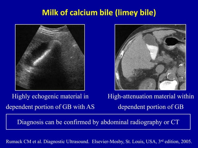 Ultrasound of the gallbladder | PPTX | Digestive Disorders | Diseases ...