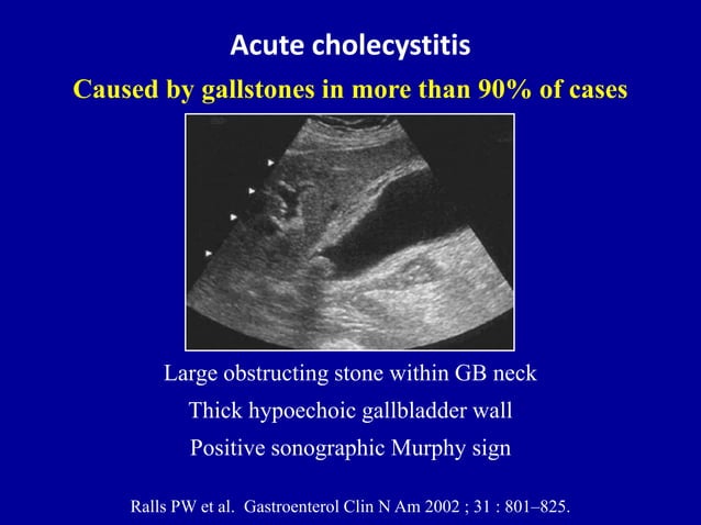 Ultrasound of the gallbladder | PPTX | Digestive Disorders | Diseases ...