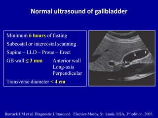 Ultrasound of the gallbladder | PPTX