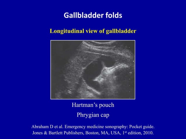 Ultrasound of the gallbladder | PPTX | Digestive Disorders | Diseases ...