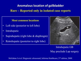 Abnormal Gallbladder Ultrasound