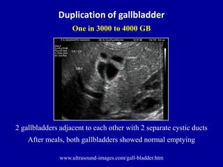 Strawberry Gallbladder Ultrasound