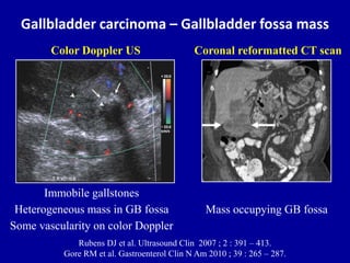 Cystic Gall Bladder Fossa