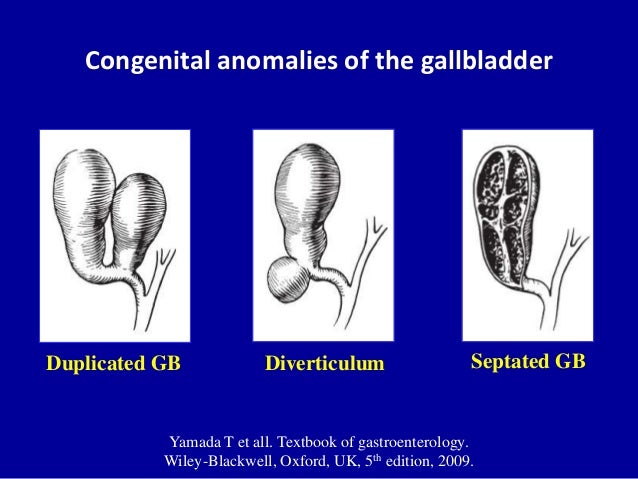 Ultrasound of the gallbladder