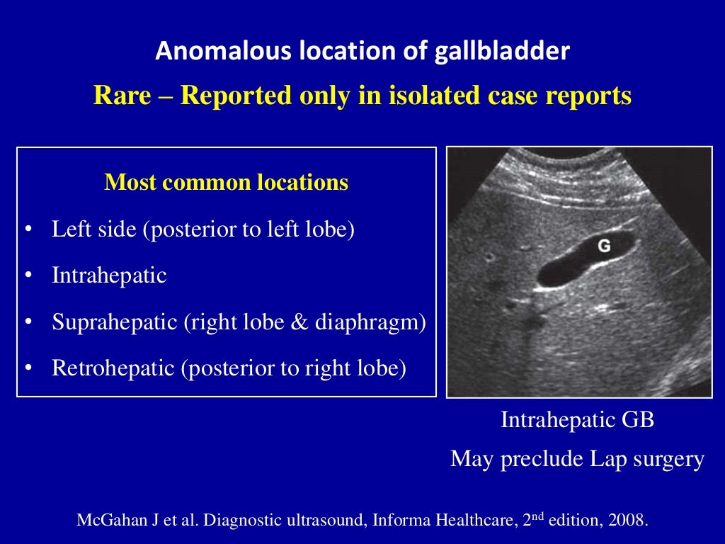 Ultrasound of the gallbladder