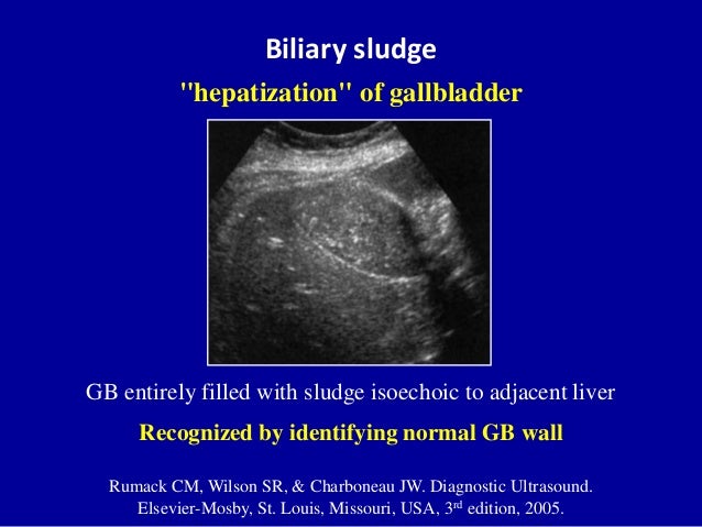 Ultrasound of the gallbladder
